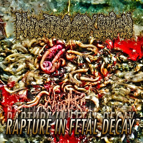 Stream Rapture In Fetal Decay By Mutated Sex Organ Listen Online For