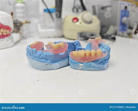 Removable Dentures For The Patient Are Made In A Dental Laboratory Stock Photo Image Of