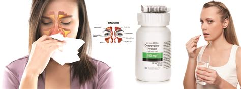 Doxycycline Hyclate Mg For Sinus Infection