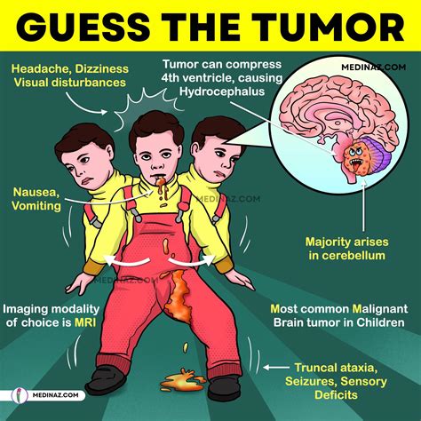Medinaz Comment Below ⬇️👇🏻 Facebook