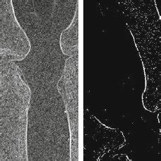 Pure Fuzzy Entropy Algorithm Applied Without Filtering The Left Download Scientific Diagram