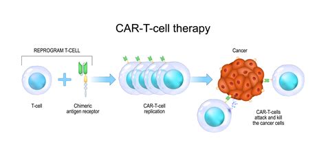 Multiple Myeloma Management Mims Malaysia