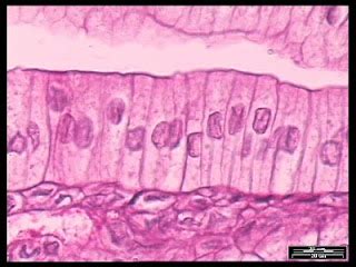Columnar Cell Meddic