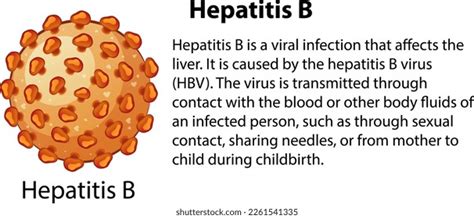 Hepatitis B Explanation Illustration Stock Vector Royalty Free