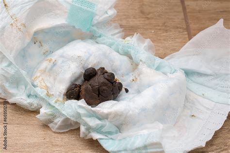 Poop In A Diaper Feces Excrement Stock Foto Adobe Stock