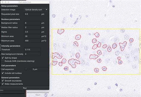 Difficulty With He Cell Detection On Qupath Usage And Issues Image Sc