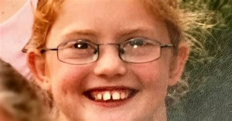 Schoolgirl Punched And Burned For Being Redhead Turns Tables On Cruel