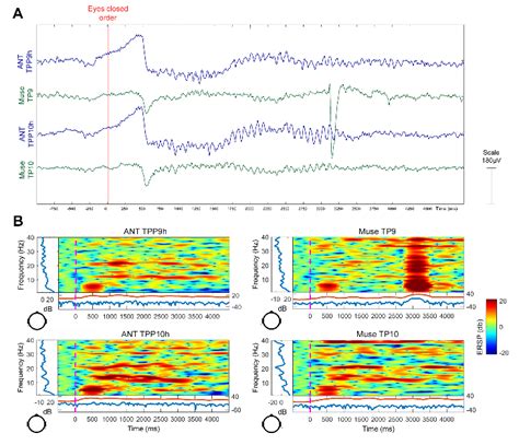Comparative Analysis Of The Same Single Eeg Trial Simultaneously