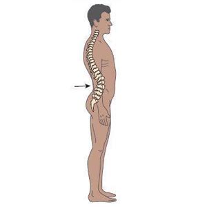 Scoliosis Treatment Curvy Back Solutions Explained