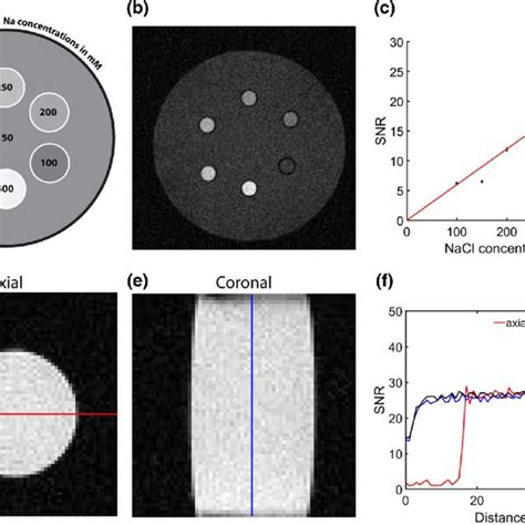 Evaluation And Quantification Of The Rf Coil Performance A Download Scientific Diagram