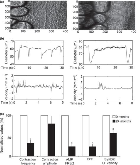 In Vivo Analysis Of Mesenteric Lymphatic Vessels Contractility A