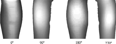 2 D Mri Projections Created From The 3 D Mri Volume The Projections