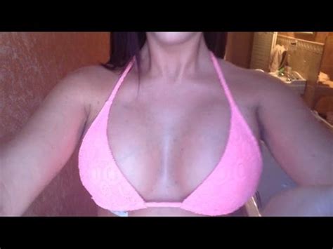 2 Days Post Op Breast Augmentation YouTube