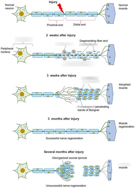 Nerve Healing Diagram Quizlet