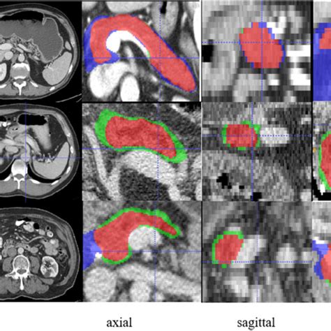 the different rows represent the segmentation results of the 3d u net