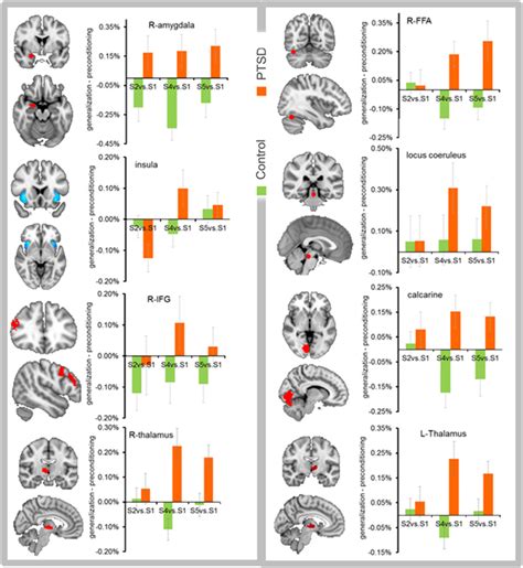 Regions Of Fear Generalization Bias In Ptsd Fear Generalization Download Scientific Diagram