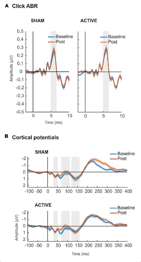 A Grand Averaged Abr Waveforms Elicited By Auditory Click Stimulus