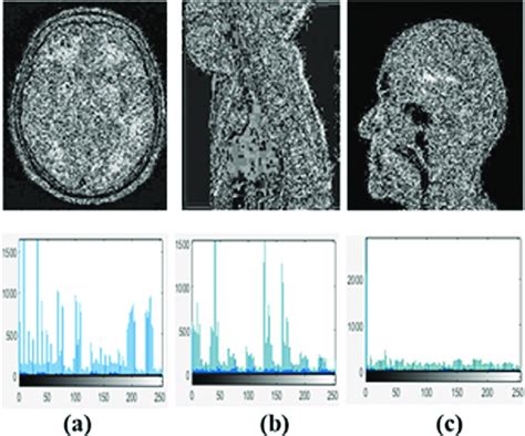 Histogram Of Three Encryption Medical Images Proposed Model For