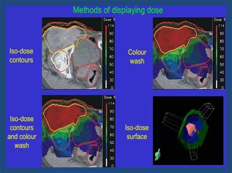 Dose Volume Histogram PPT D Graphics Computer Software And Applications