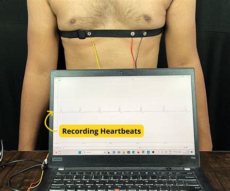 Detecting Heart Beats Using Bioamp Exg Pill 9 Steps With Pictures Instructables