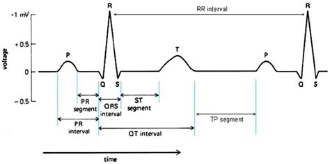 Electronics Free Full Text Multiclass Ecg Signal Analysis Using