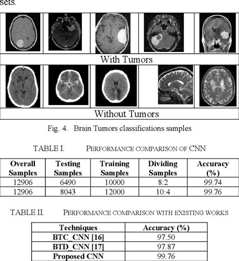 figure 4 from cnn based deep learning approach for mri based brain tumor detection semantic
