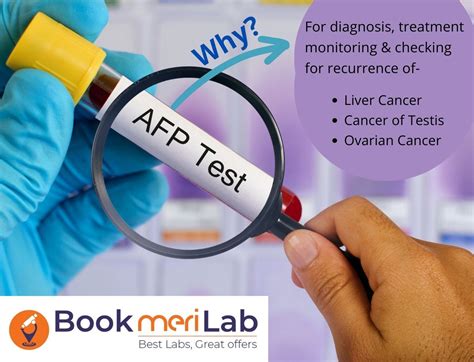 Afp Tumor Marker Test Price Purpose Procedure And Range