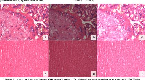 Figure 2 From A Hardware Approach For Histological And Histopathological Digital Image Stain