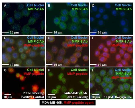 MMP Cell Images Human Breast Cancer Cell Line MDA MB 468 Was Download Scientific Diagram