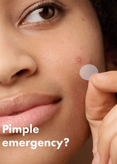 The Best Pimple Patches That Will Zap Your Zits