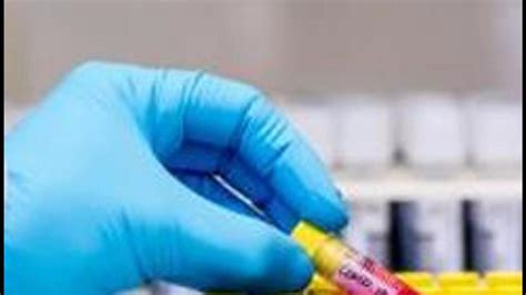 New Zoonotic Virus Found In China 35 Known Cases Of Infection Study