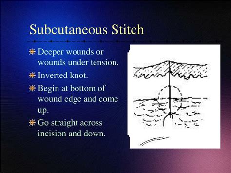 Ppt Advanced Suturing Techniques Powerpoint Presentation Free