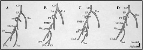 In Female Subjects Figures Showing The Various Origins Of The Inferior