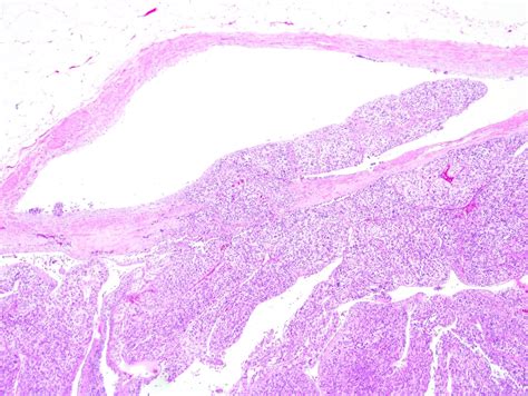 Renal Sinus Histology