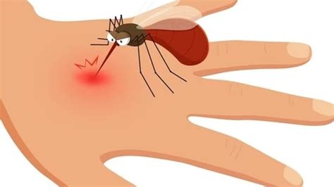 Dengue Surge Mild To Dangerous Common Signs And Symptoms Of Different Dengue Strains Health