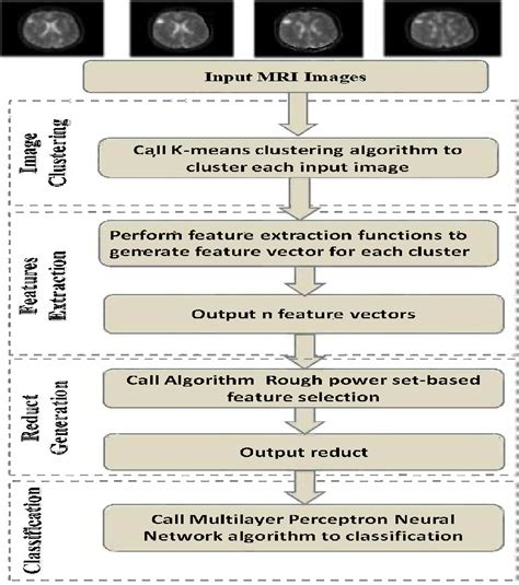 2d Brain Tumor Feature Selection And Classification Proposed Scheme Download Scientific Diagram