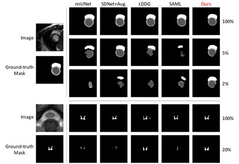 fig a2 we show the example images and predicted segmentation masks of