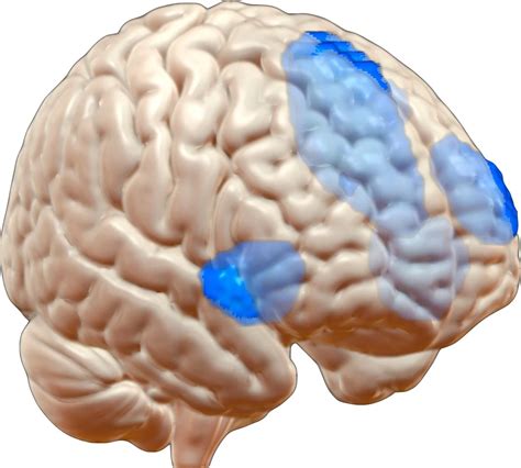What Is The Cingulo Opercular Network — Hearing Health Foundation