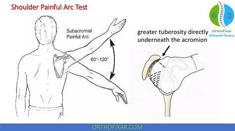 Shoulder Abduction Relief Test