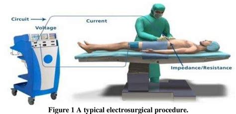 Figure 1 From Comparative Analysis Of Integer And Fractional Pid For