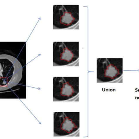 Lung Nodule Extraction Procedure Download Scientific Diagram