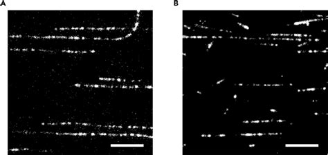 Representative Total Internal Reflection Fluorescence Tirf Microscopy
