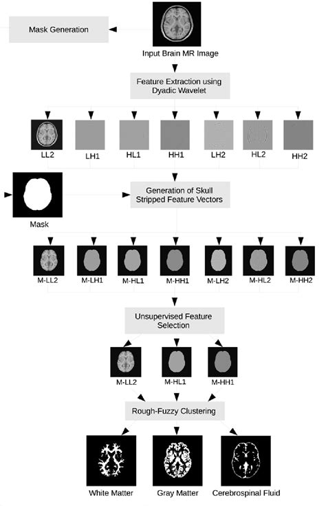 figure 1 from rough fuzzy clustering and unsupervised feature selection for wavelet based mr