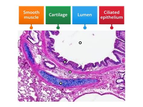 As Bronchus Micrograph Labelled Diagram
