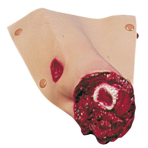 Simulaids Bleeding Moulage Leg Amputation Medtree