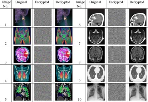 Visual Security Findings Of Color And Gray Medical Images Download Scientific Diagram