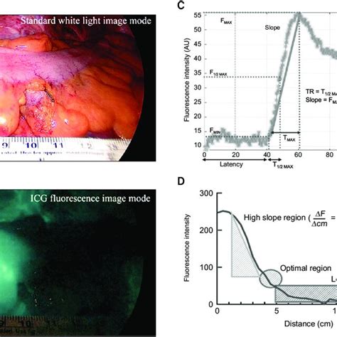 Indocyanine Green Fluorescence Image Icg Fi Use For Anastomotic Download Scientific Diagram