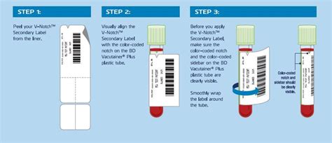 بسم الله الرحمن الرحيم 7220 Labelling Of Specimen Container