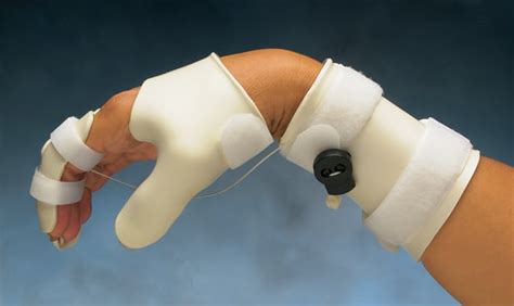 Tenodesis Thermoplastic Splint Kit North Coast Medical