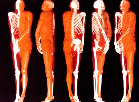 “volume Rendering” Acm Siggraph History Archives